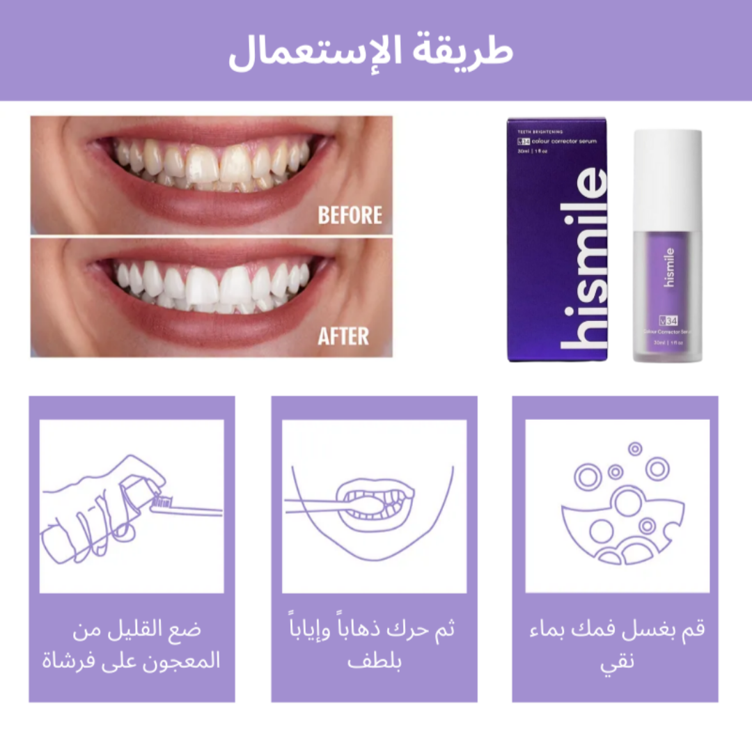 Hi Smile MA – Para Maroc